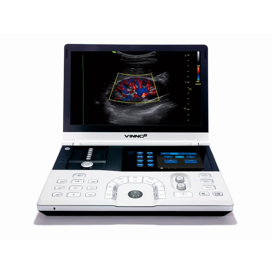 УЗИ аппарат VINNO VINNO 8 купить по цене 745 700 руб. в городе Москва