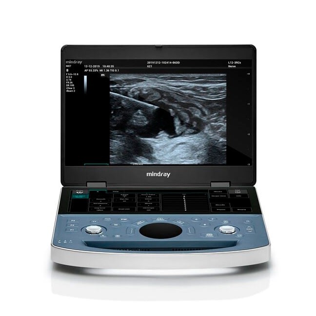 Портативный УЗИ-аппарат Mindray ME7 | Медик-Сервис